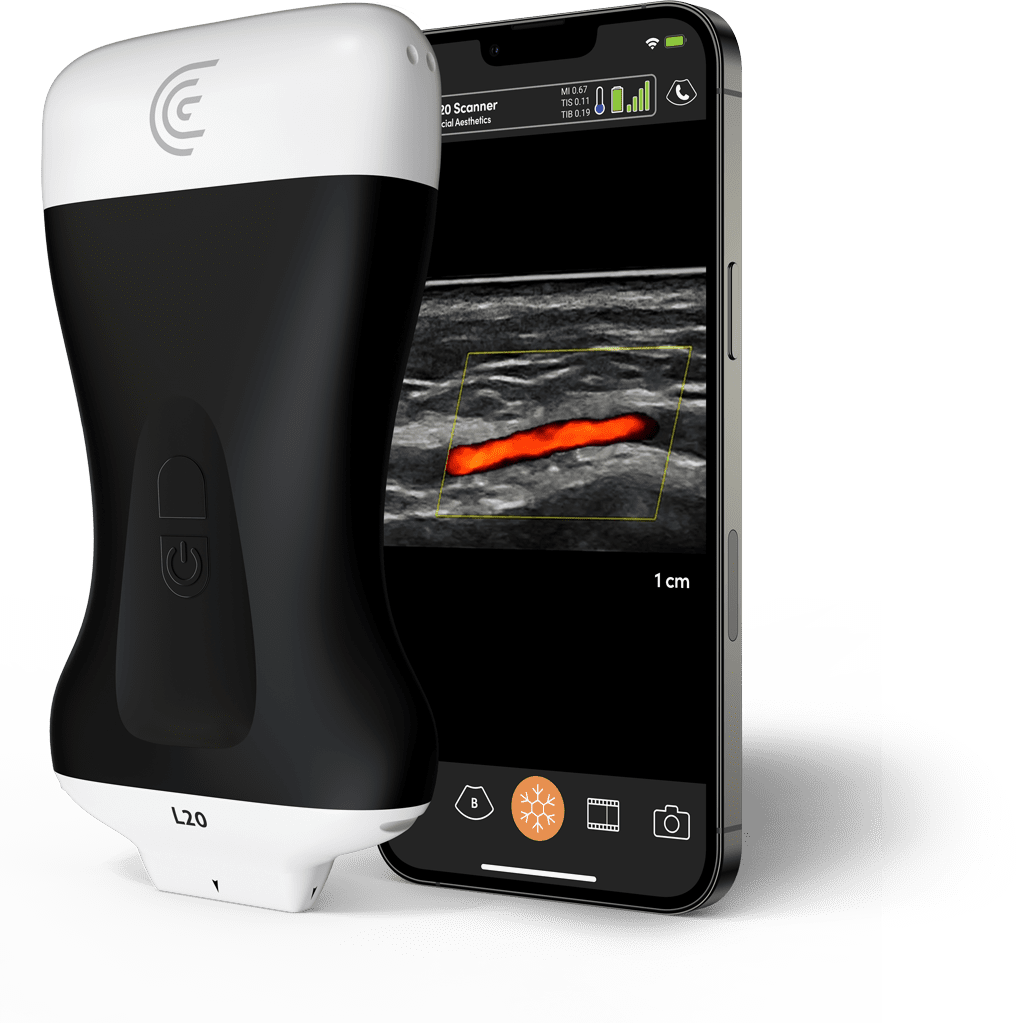 Ultrasound Technology In Brentwood | Movel Medical Aesthetics